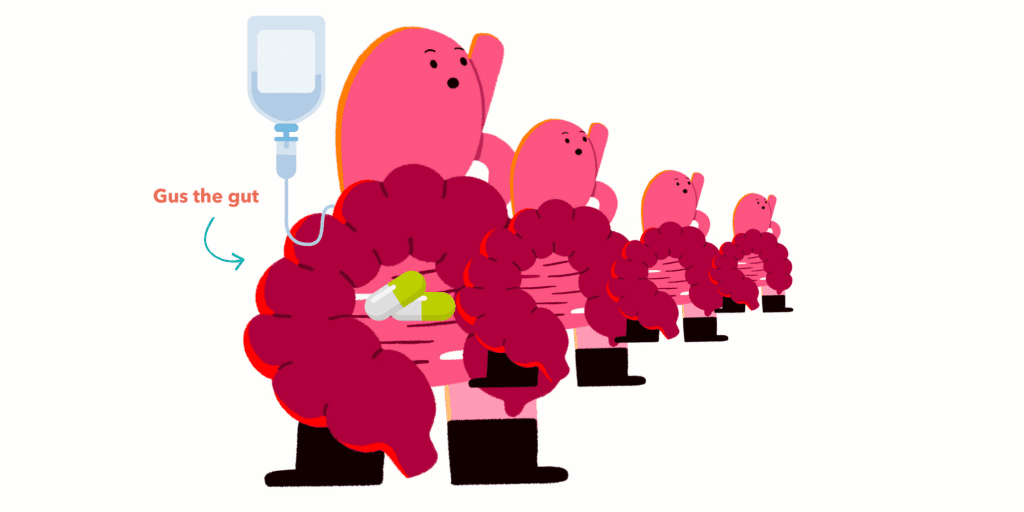 Inflammatory bowel disease (IBD) - Guts UK